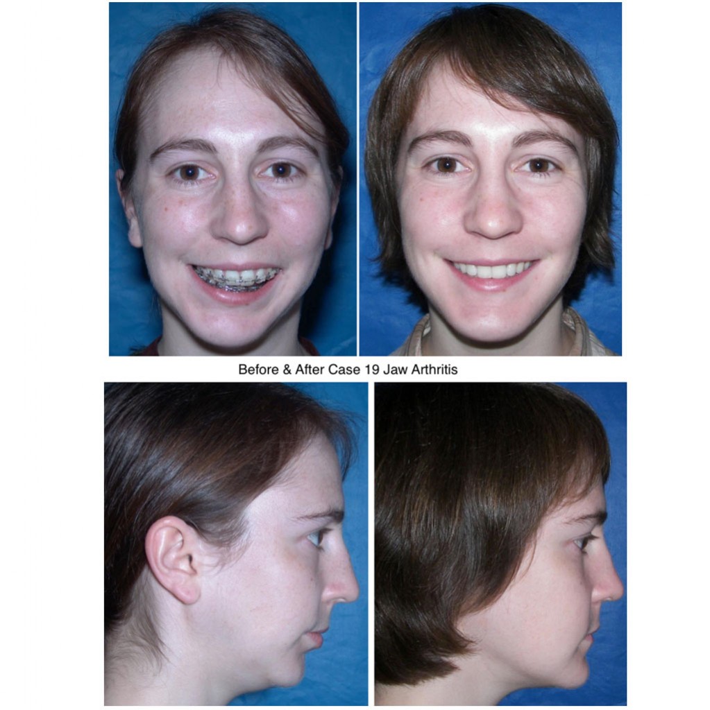 Before & After Surgery Photos | Dr. Larry M. Wolford, DMD