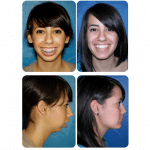 Before & After Surgery Photos | Dr. Larry M. Wolford, DMD