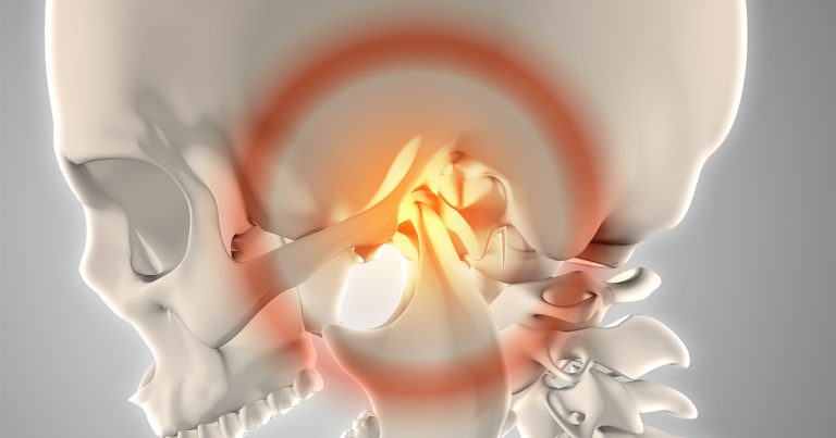 What is Displaced Articular Disc TMJ Disorder? | Dr. Larry M. Wolford, DMD